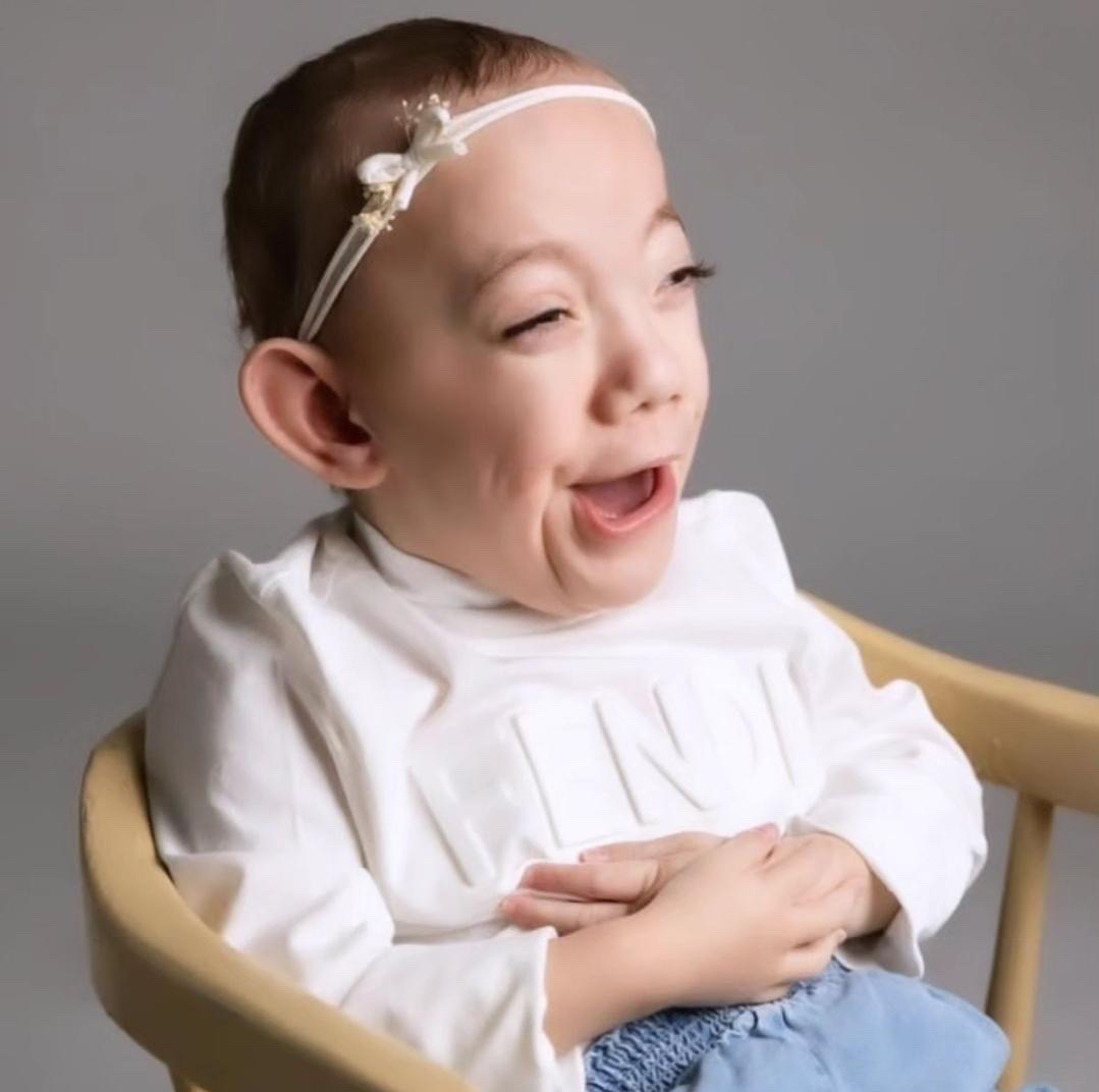 Schaaf Yang Syndrome – Foundation for Prader Willi Research